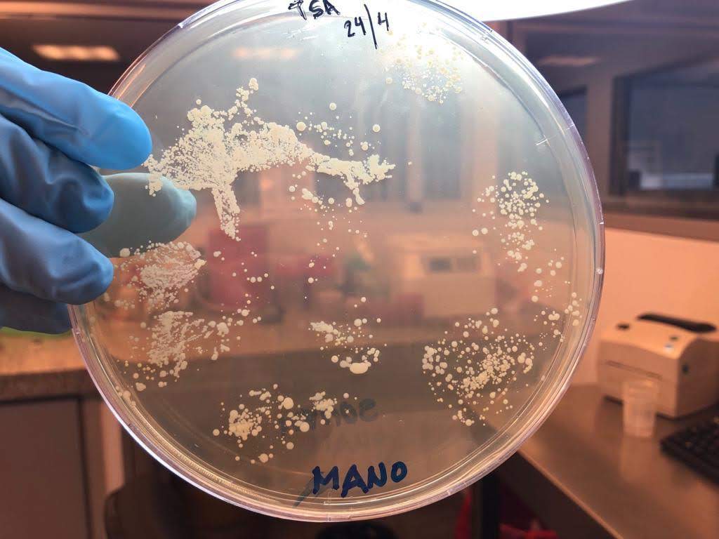 ASSE - Lavado de Manos: Método simple y eficaz para disminuir infecciones
